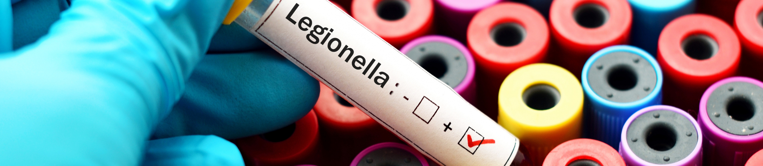 Legionella: what’s the deal? - Food Alert
